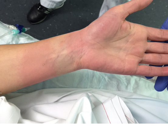 © Universitätsklinik für Plastische- und Handchirurgie, Inselspital Bern